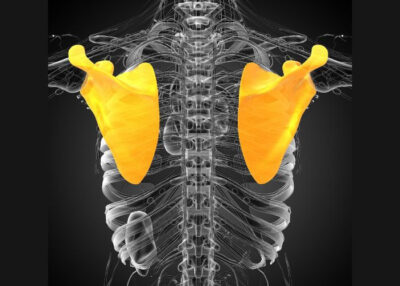 Scapulothoracic Bursitis | Snapping Scapula Syndrome | Vail, Aspen ...