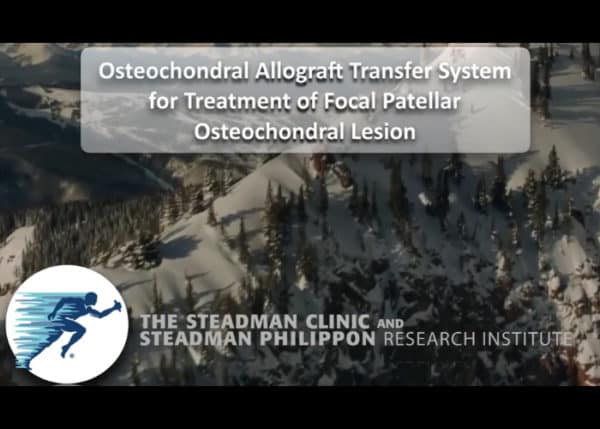 Osteochondral Allograft Transfer for The Treatment of Focal Patellar ...