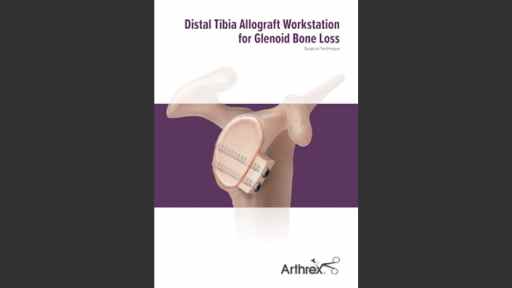 Arthrex Education - Matthew Provencher, MD | Orthopedic Knee & Shoulder ...