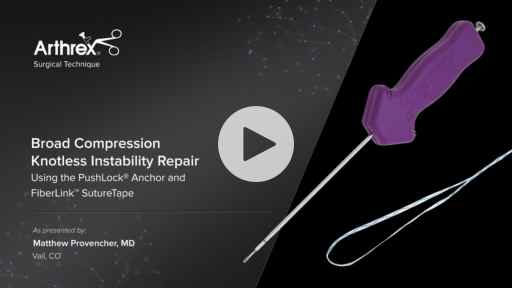 Arthrex Education - Matthew Provencher, MD | Orthopedic Knee & Shoulder ...