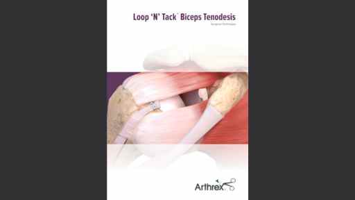 Arthrex Education - Matthew Provencher, MD | Orthopedic Knee & Shoulder ...